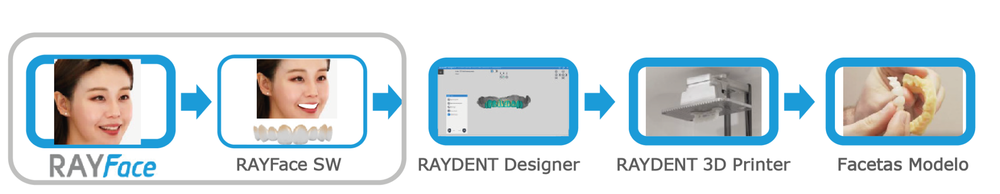 Escáner facial 3D RAYFACE » P-Ortho
