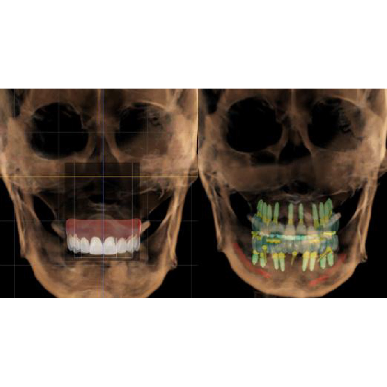 Escáner facial 3D RAYFACE » P-Ortho