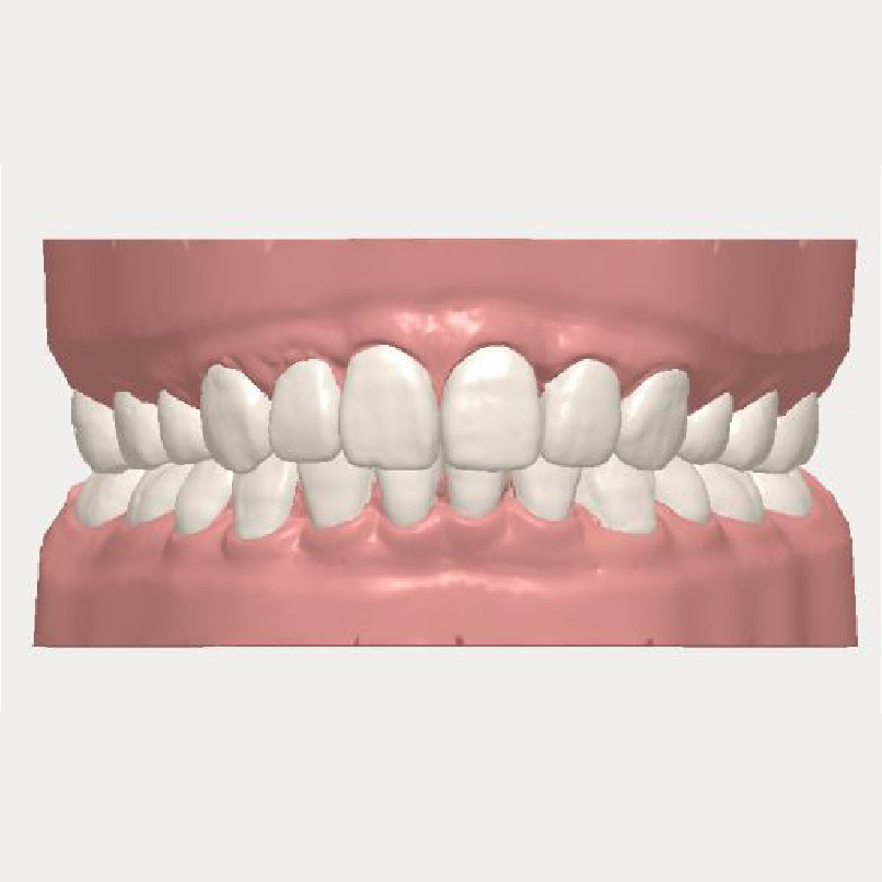 Escáner facial 3D RAYFACE » P-Ortho