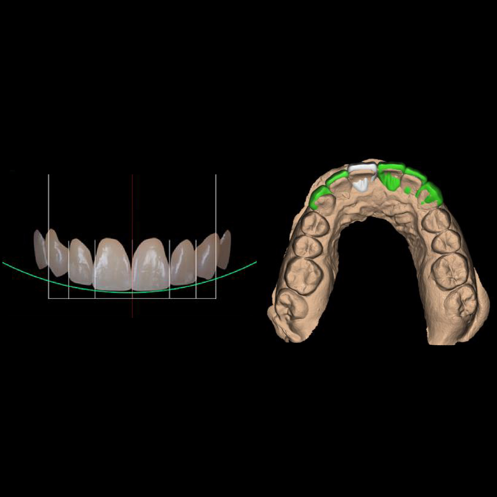 Escáner facial 3D RAYFACE » P-Ortho